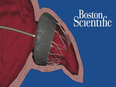 Product Review: Boston Scientific WATCHMAN FLX | TechSci Research